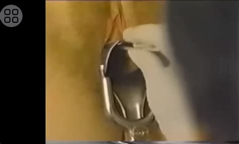 Pelvic Exam Training Video ThisVid Com