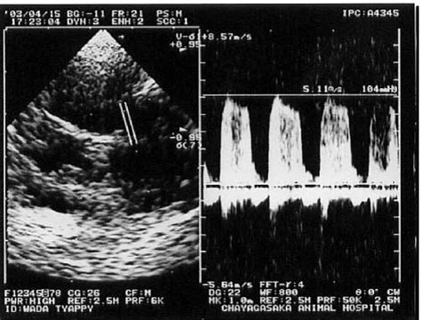 Continuous Wave Doppler Echocardiography At The Pulmonic Valve The
