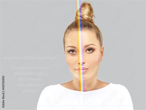 Negative Effects Of Sunlight Hyperpigmentation Premature Aging Sun Allergies Skin Diseases