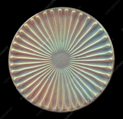 Diatom Sem Stock Image F043 7882 Science Photo Library
