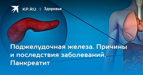 Поджелудочная железа Причины и последствия заболеваний Панкреатит