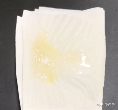 固柢锻炼日记惊喜带瘀血的瘀堵毒素排出来了 知乎