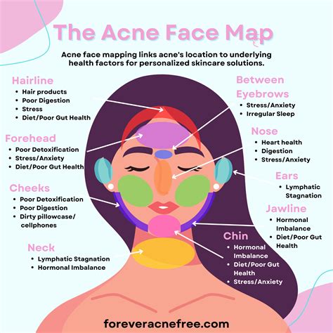 The Acne Face Map Acne Face Mapping What Your Breakouts Mean Acne Solutions Opens A New Tab
