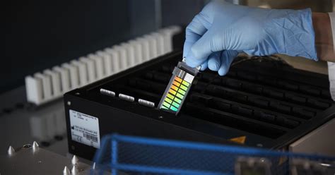 Genome Wide Genotyping Arrays Genome Analysis University Of Helsinki