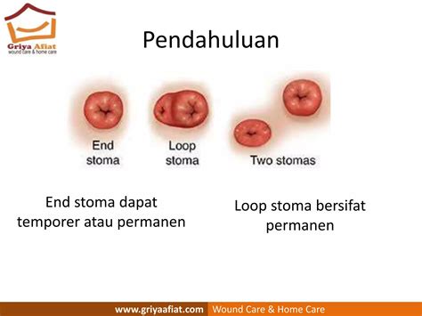 1 Konsep Dasar Stoma Pptx