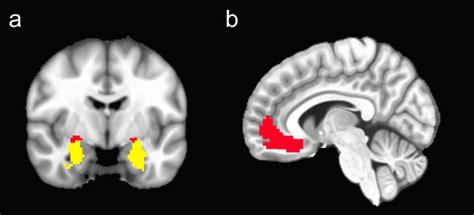 Regions Of Interest Rois Including A Basolateral Amygdala Bla