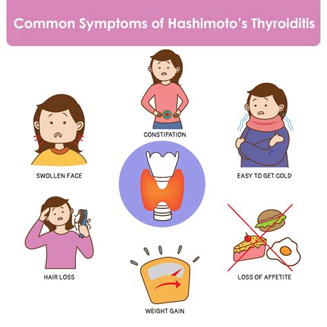 Natural Hashimotos Remedies Naturopathic Approaches From Avena Health
