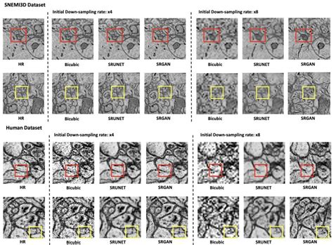 The Visualizations Of Reconstruction Image Quality For Isr Different