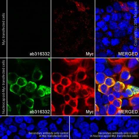 Anti Mers Cov Nucleocapsid Protein Antibody [abd211] Ab316332 Abcam