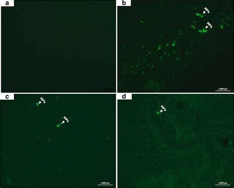 Fluorescence Photomicrographs Showing Microscopic Detection Of