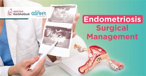 Endometriosis Surgical Management Ggirhr