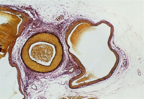 LM Of A Cross Section Through An Artery And Vein Stock Image P206 0116 Science Photo Library
