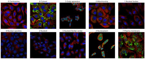 Medical Multi Label Classification With Pytorch And Lightning