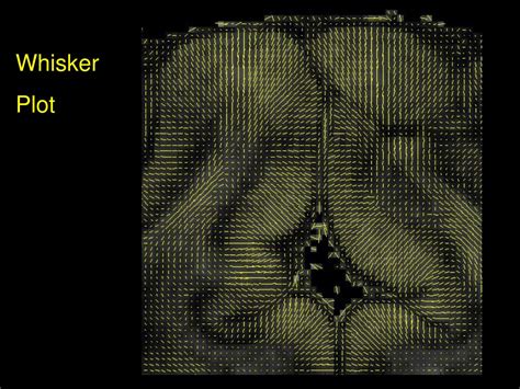 Ppt Mapping Cortical Development Using Diffusion Tensor Imaging Powerpoint Presentation Id