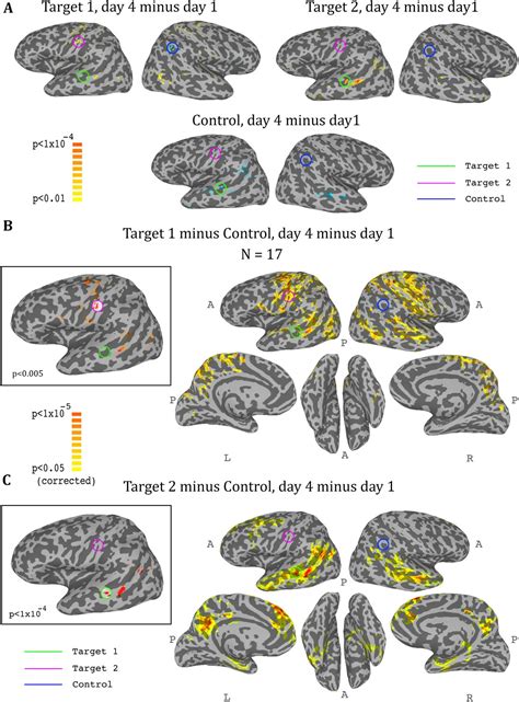 Figures And Data In Direct Modulation Of Aberrant Brain Network Connectivity Through Real Time
