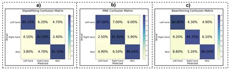 Integrating Electroencephalography Source Localization And Residual Convolutional Neural Network