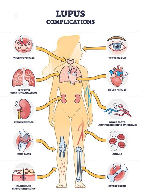 Herpes Symptoms With Genital Oral And Recurrent Outbreaks Outline