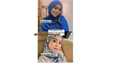 Perbedaan Wajah Lesti Sebelum Dan Sesudah Menikah Yang Sekarang Bikin Netizen Sedih Paperplane