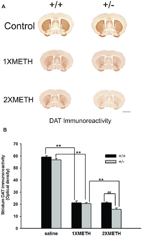 Decreased Da Clearance Due To Loss Of Dat Expression In Striatum A Download Scientific