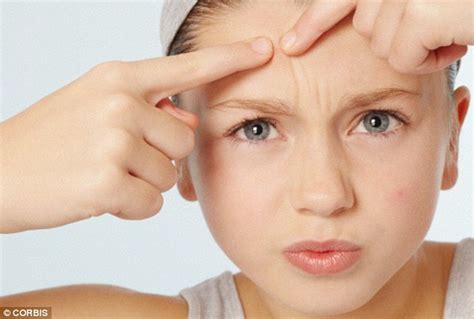 Is It Bad To Pop Your Spots Dermatologist Reveals Why We Get Pimples Daily Mail Online