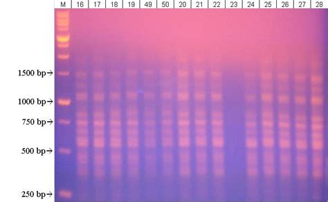 7 Issr Pcr Products By Ac 8yc Primer Checked On 1 5 Agarose Gel Download Scientific Diagram