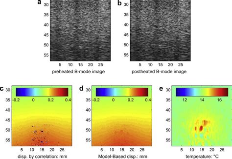 Temperature Estimation Using The Model Based Outlier Removal Algorithm Download Scientific