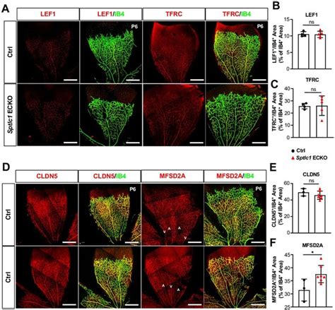 Murine Endothelial Serine Palmitoyltransferase 1 Sptlc1 Is Required