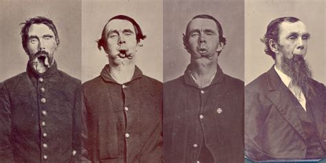 Mending Broken Faces Of War Civil War Medicine National Museum Of