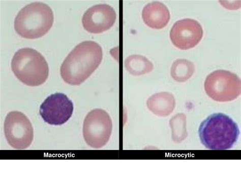 PPT RED BLOOD CELLS PowerPoint Presentation Free Download ID