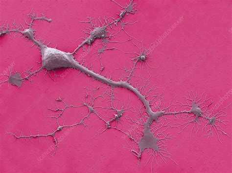 Stem Cell Derived Neuron Sem Stock Image C0296001 Science Photo