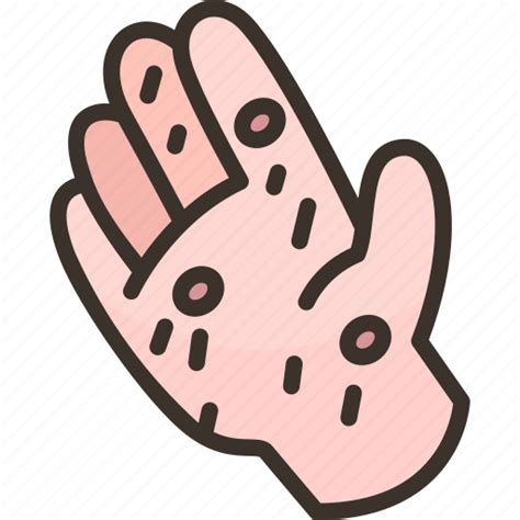 Atopic Dermatitis Skin Allergy Inflammation Icon Download On