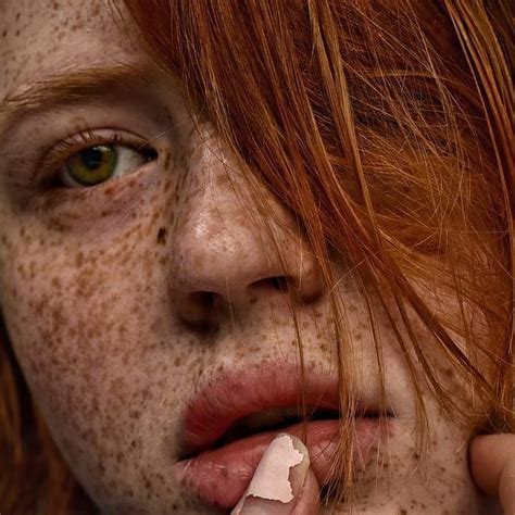 Pin On Freckles