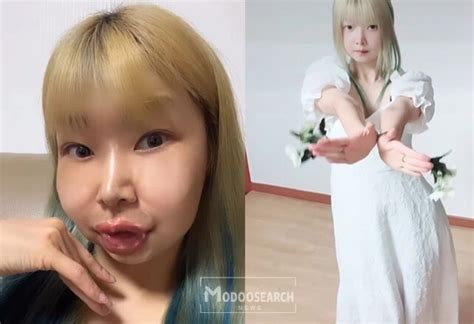 나는 솔로 10기 영자 양악 수술 후 정신 이상설 해명 저는 정신 건강해요