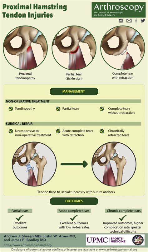 Proximal Hamstring Tendon