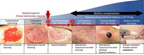 Ozone As A Topical Treatment For Infected Dermal Wounds Rahim Rahimi