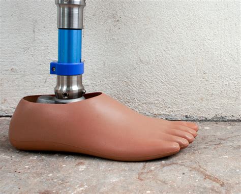 Diabetes Patients Preventing Amputation