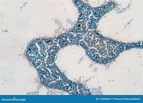 Saccharomyces Cerevisiae Yeast Budding Cell Under Microscope Stock Image Image Of Beverages