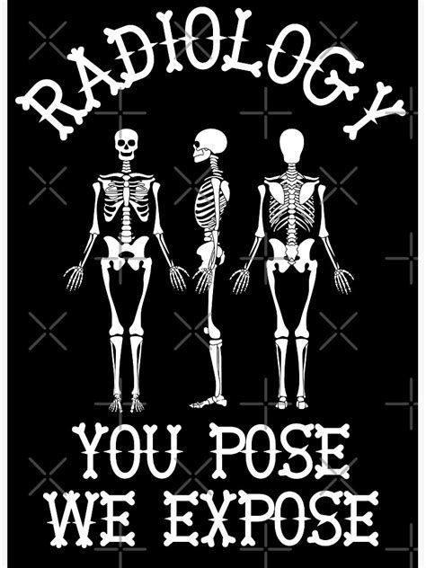 Radiology You Pose We Expose Art Print For Sale By Faslab Redbubble
