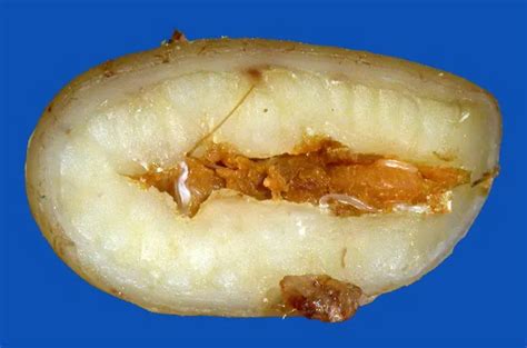 Enterobius Vermicularis