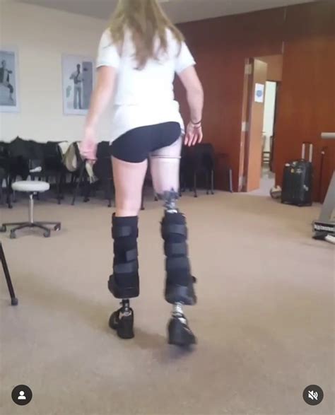 Sak Amputee Trying Dbk Simulator With Cams