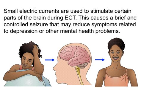 Electroshock Therapy 