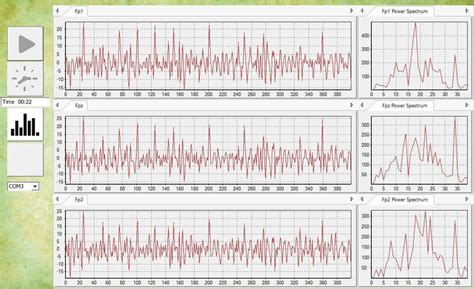 The Real Time Visual Display System Shows The Eeg Signals After Download Scientific Diagram