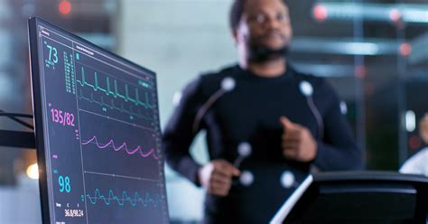 Cardiac Event Monitors Medstar Health