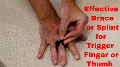 Trigger Finger Splint Orfit At Stephen Bobo Blog