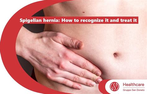 Spigelian Hernia Symptoms Get A Clarity On Symptoms And Types Of