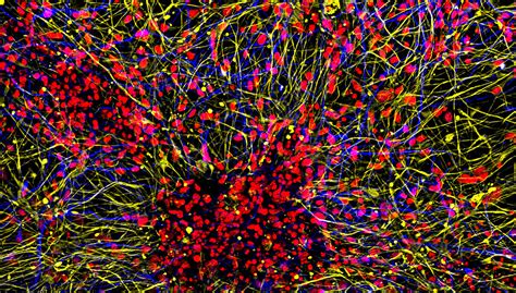 Investigation To Explore Brain Aging In Space To Fly On Spacex Crs 29 Iss National Lab