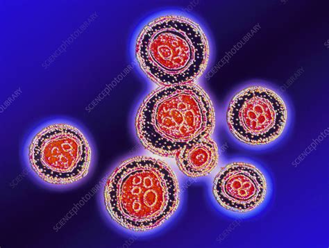 Lm Of Cryptococcus Neoformans Fungi Stock Image B250 0656 Science