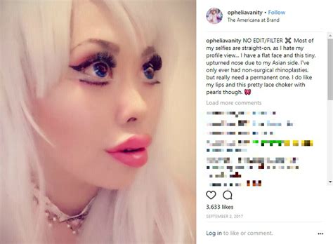 Half Chinese Woman Undergoes Extensive Cosmetic Surgery To Become The