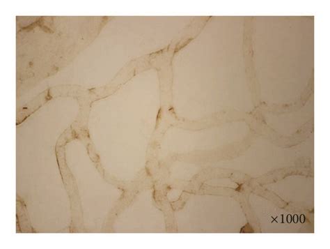 effects of twod on occludin levels in diabetic rats twod group and cad