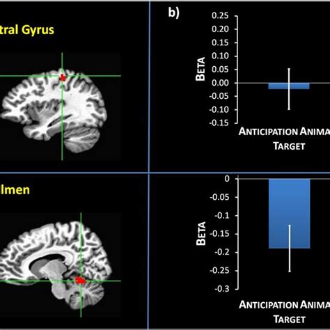 Task Induced Activity Group Statistical Maps Of A Whole Brain